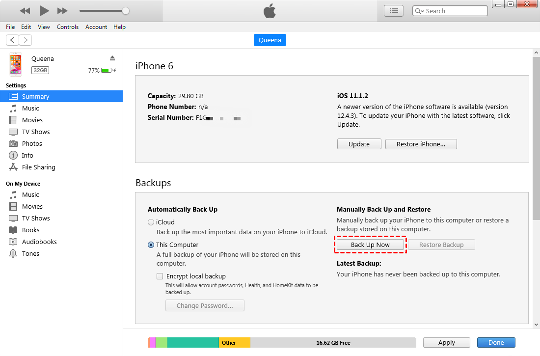 [4 Easy Ways] How to Backup iPhone Contacts to OneDrive